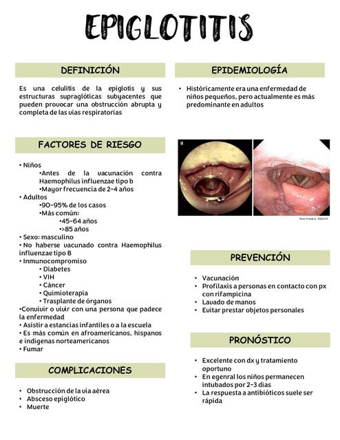 Epiglotitis | Medlink.t | uDocz