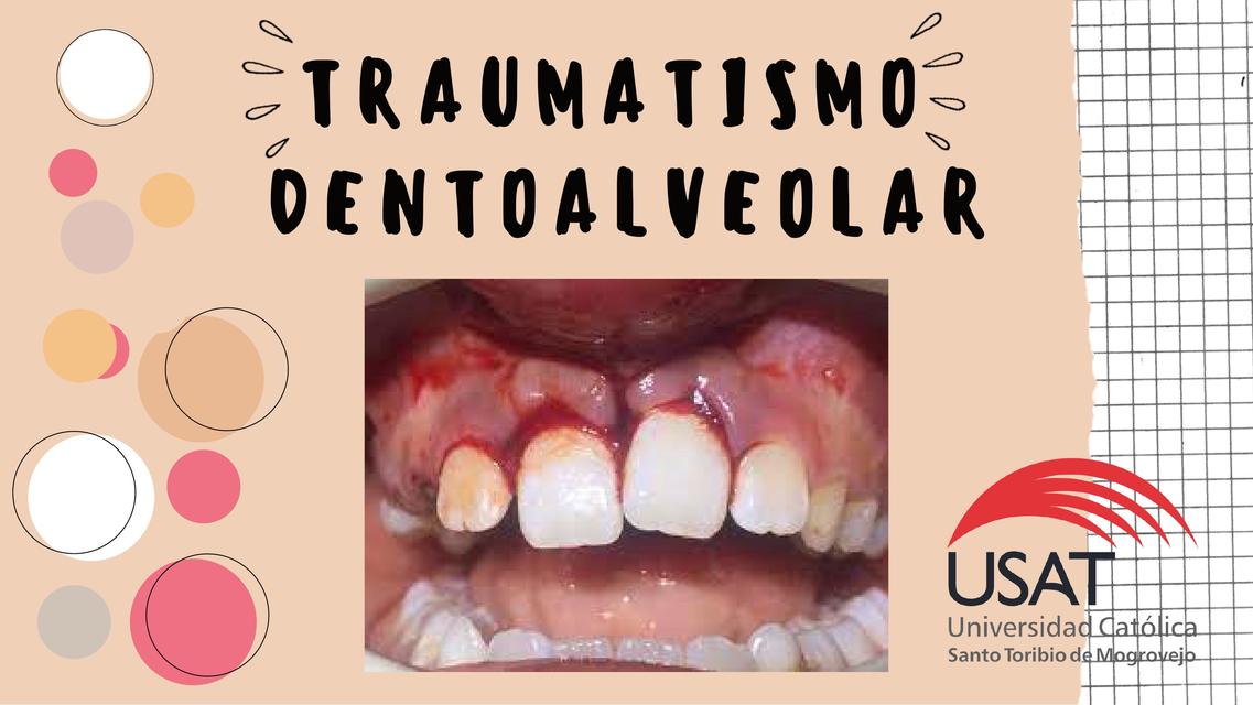 TRAUMATISMO DENTOALVEOLAR | Nicole Herrea Carranza | uDocz