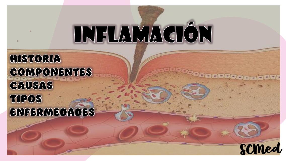 Inflamación | uDocz