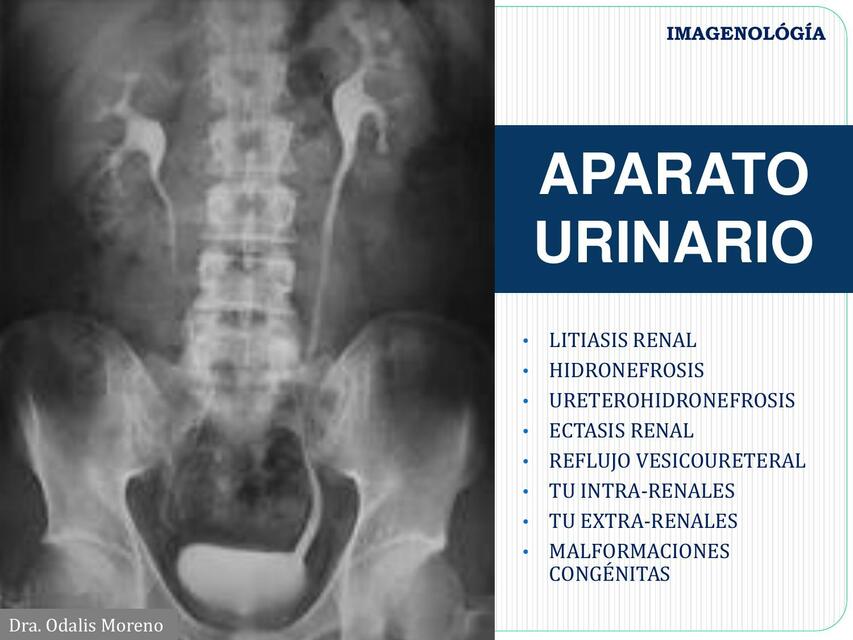 📸 SISTEMA URINARIO🍍🍍- IMAGENOLOGÍA (Imágenes de casos clínicos)🩻 | Dra Odalis Moreno | uDocz