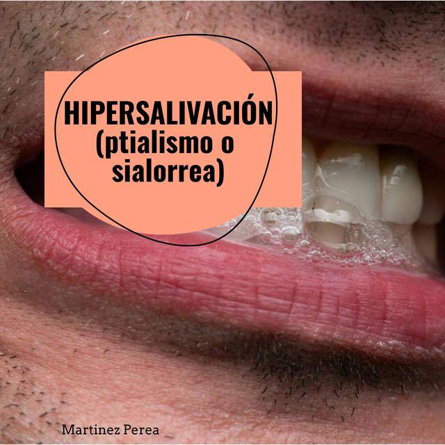 Hipersalivación (ptilismo o sialorrea) | Mauro Martinez | uDocz