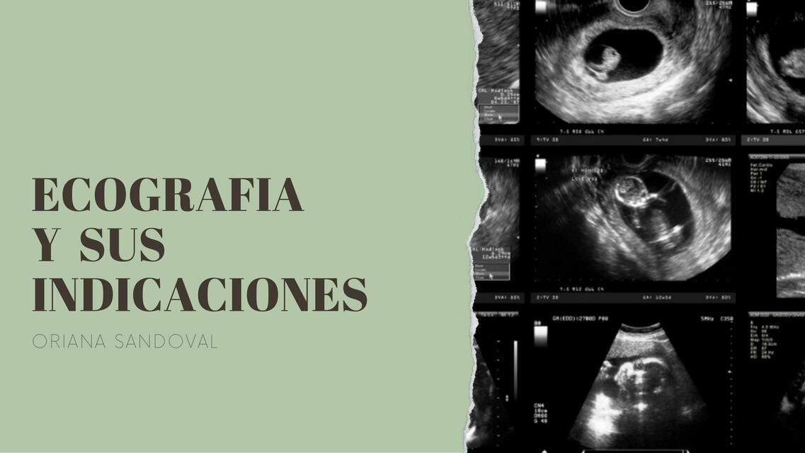 Ecografía y sus indicaciones | Samay Sandoval | uDocz