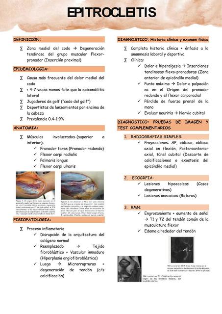 Epitrocleitis | CHUQUIMEDIC | uDocz