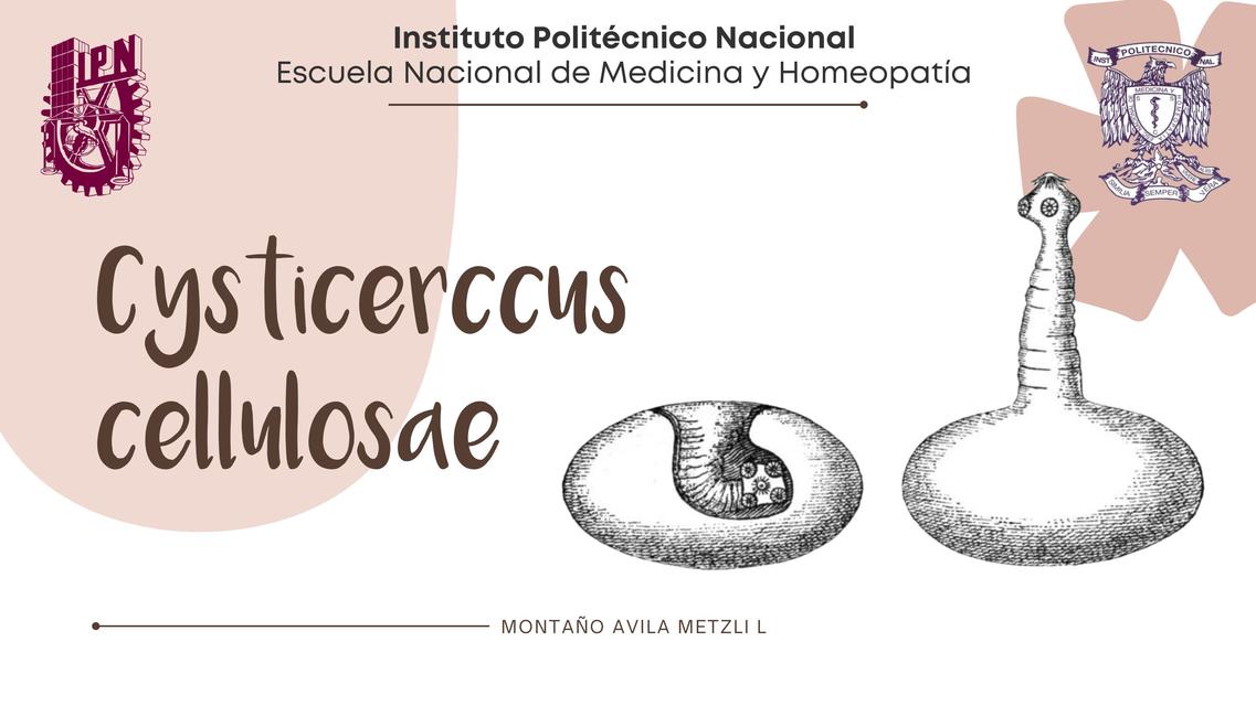 Cysticerccus cellulosae | Metzli Montaño Avila | uDocz