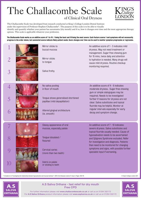 Challacombe Scale oral dryness ENG | Mauro Martinez | uDocz