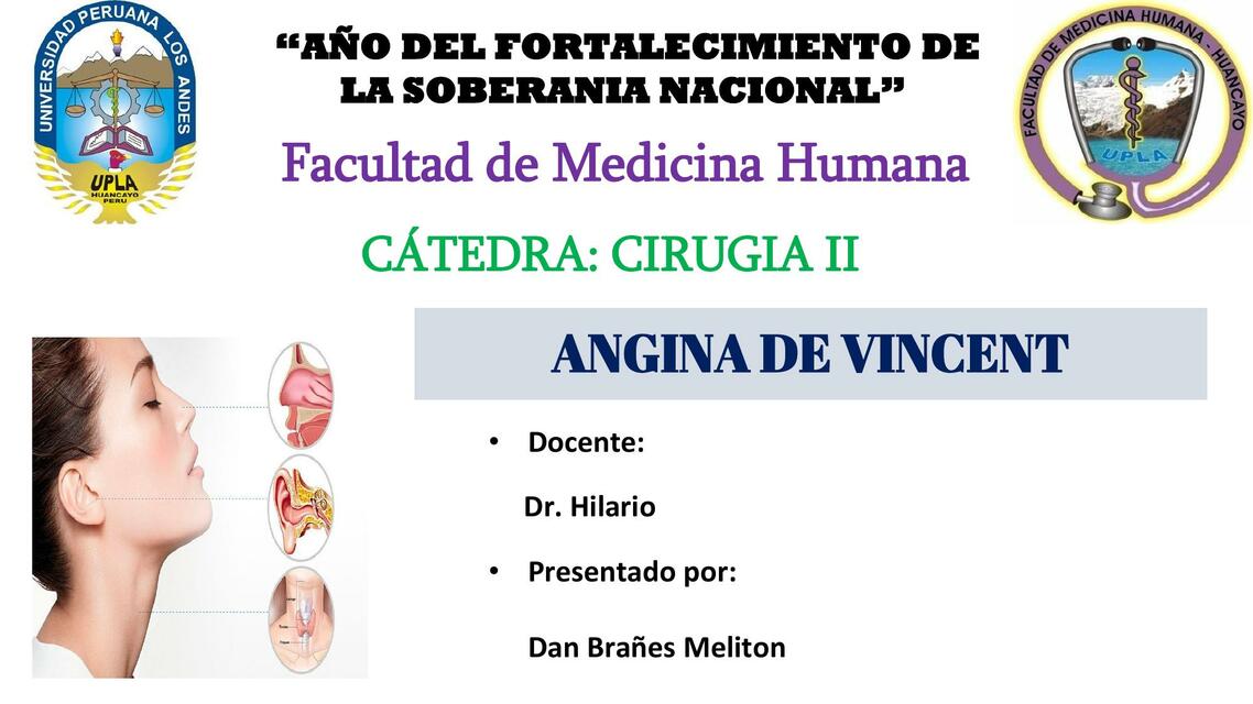 Angina de Vicent | Mishelle Chavez | uDocz