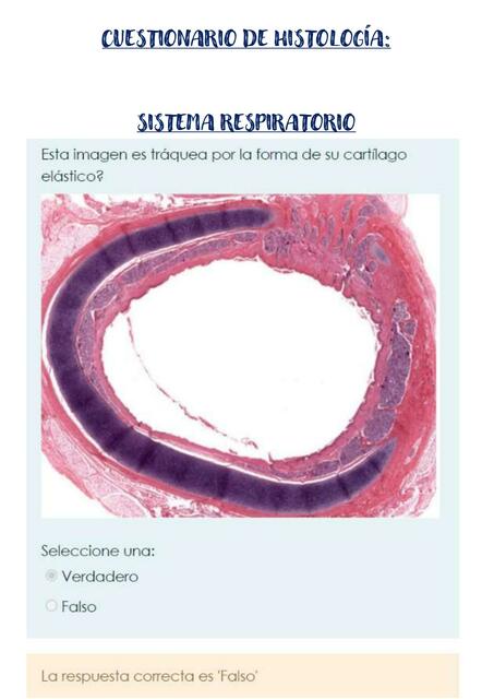 Histología 8P Sistema respiratorio | Briggitte Yamilé Suarez Esteban | uDocz