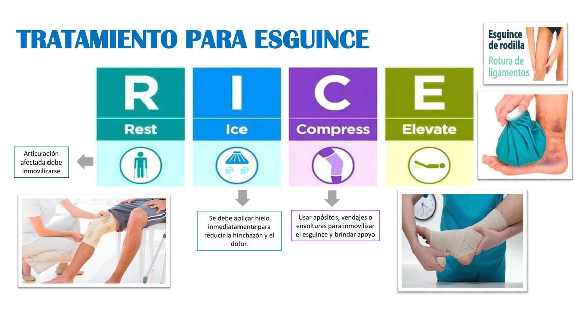 Tratamiento para esguince | Lilibeth Zambrano | uDocz