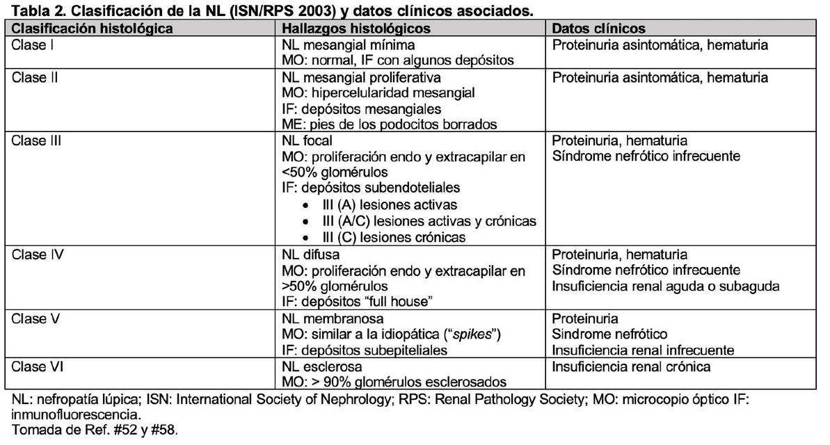 Nefropatía diabética HTA lúpico y edemas | Cristhian Sequeira | uDocz