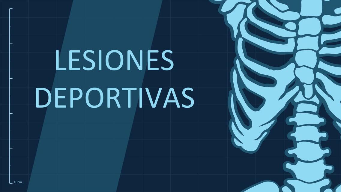 Lesiones Deportivas | Vanessa NV | uDocz