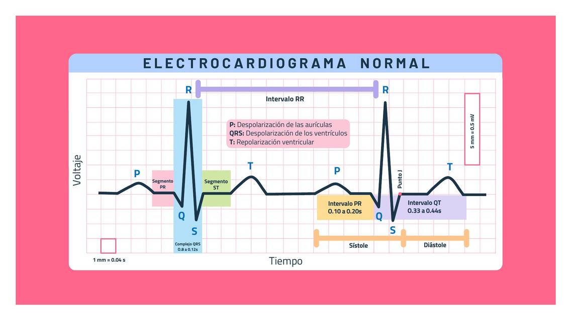 Electrocardiograma | Javier Rios | uDocz