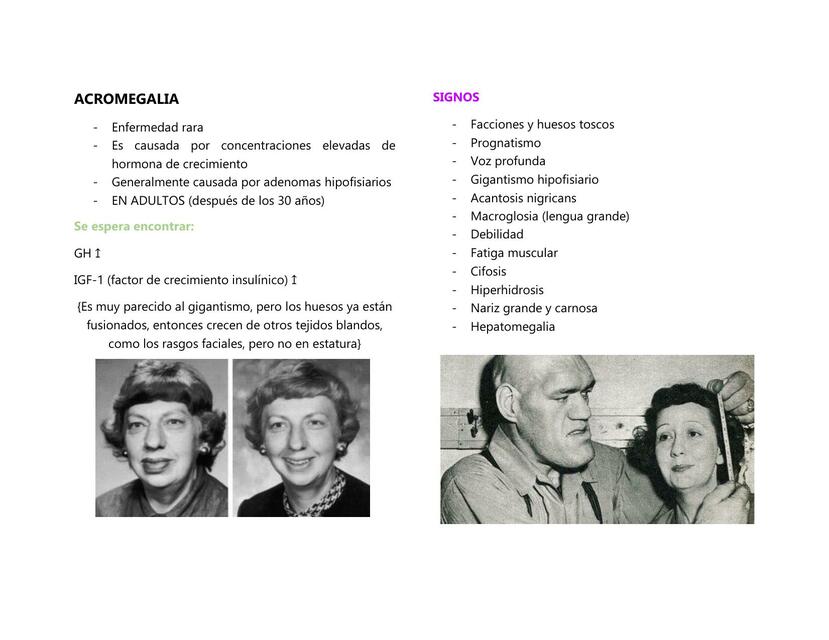 Acromegalia | Alexa Rodriguez | uDocz