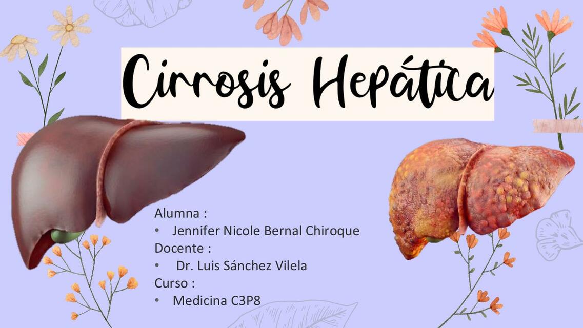 Cirrosis hepatica | Ana | uDocz