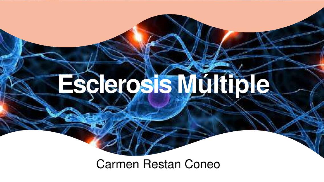 Esclerosis Múltiple | APUNTES DE MEDICINA | uDocz