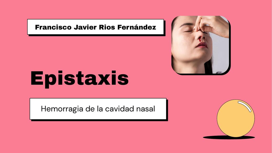Epistaxis - Sangrado nasal | Javier Rios | uDocz