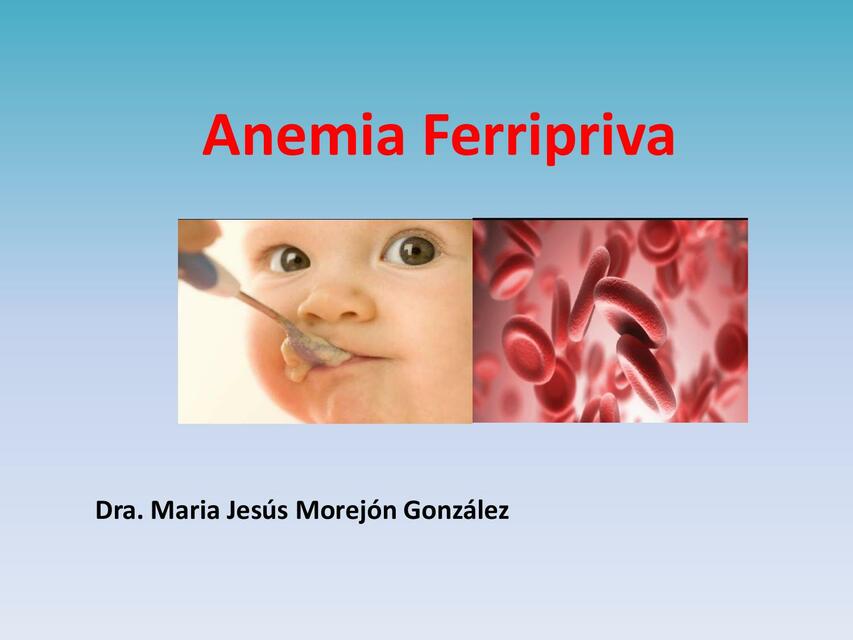 Anemia por Déficit de Hierro | Dr gomez | uDocz