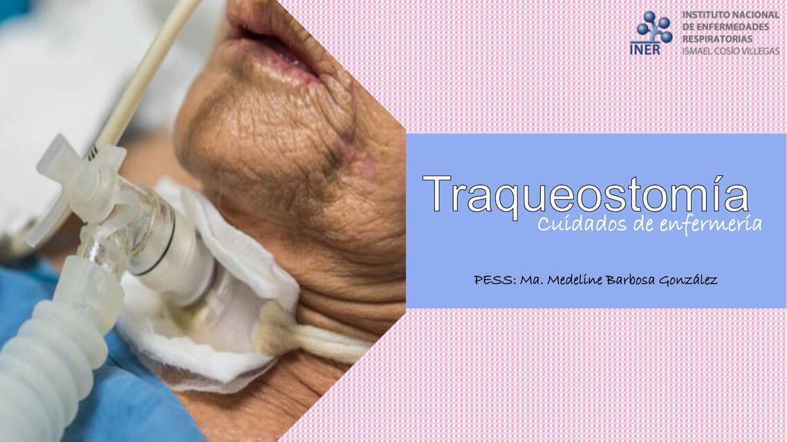 Traqueostomía | Nursemeed | uDocz