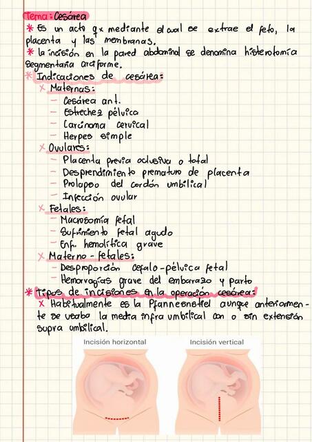 Cesarea | Valentina Lopez | uDocz