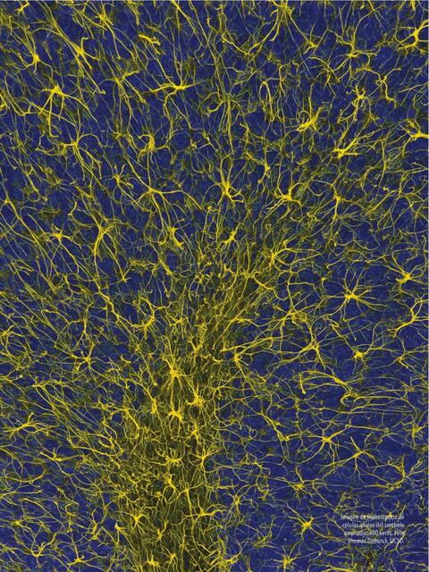 Células Gliales ¿Servidoras de las Neuronas o Compañeras de Equipo ...