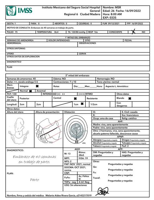 Ejemplo de Partograma | Melanie Rivera | uDocz