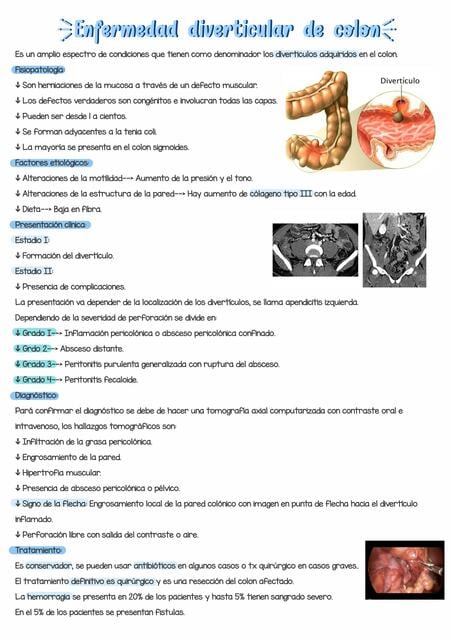 Enfermedad diverticular de colon | Medicina.zip | uDocz