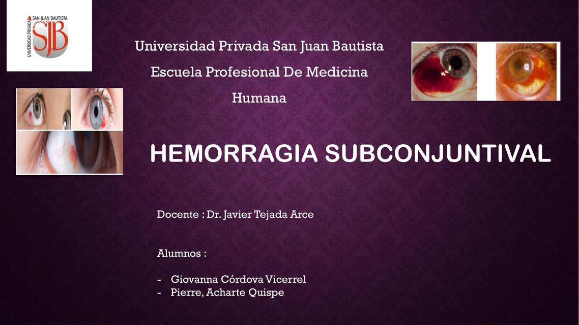 hemorragea conjuntival | Pierre Acharte | uDocz