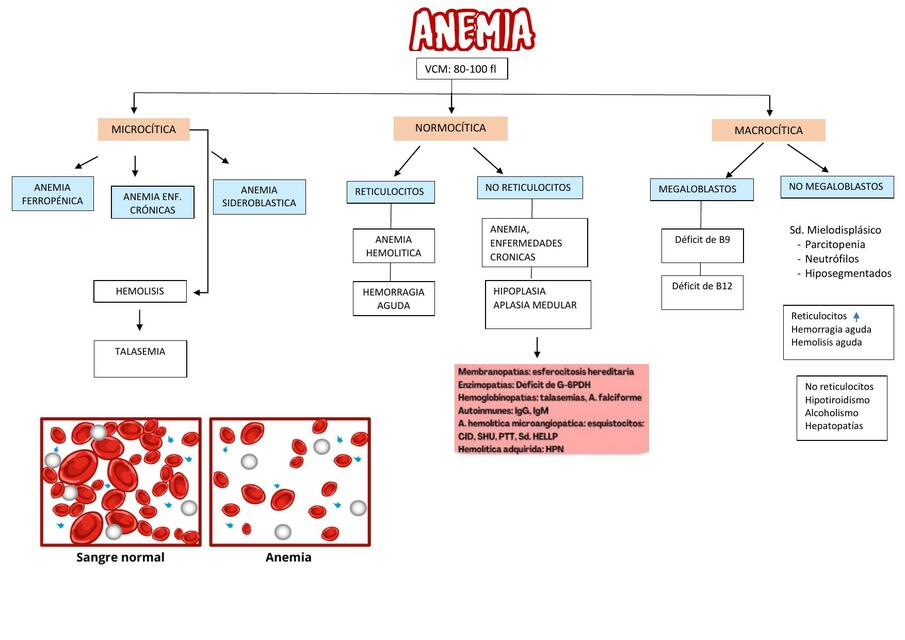 Resúmenes de Anemia microcítica | Descarga apuntes de Anemia microcítica