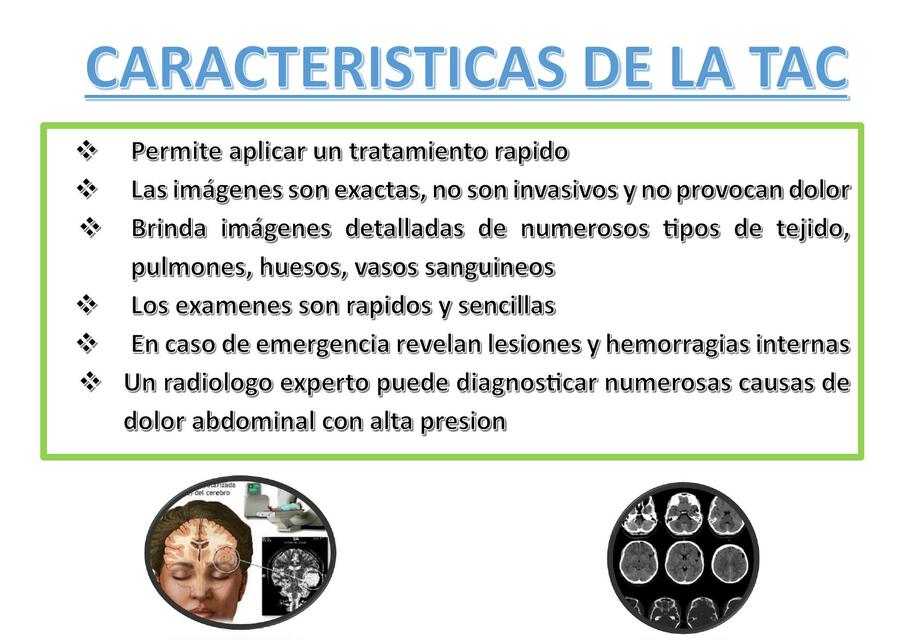Características Tac | SHAROM PILAR CLEMENTE SEDANO | uDocz