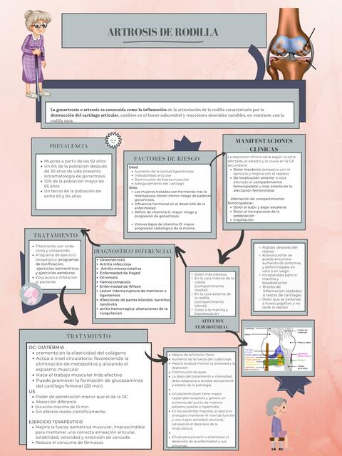 Artrosis de rodilla | ANA MARIA de la luz | uDocz