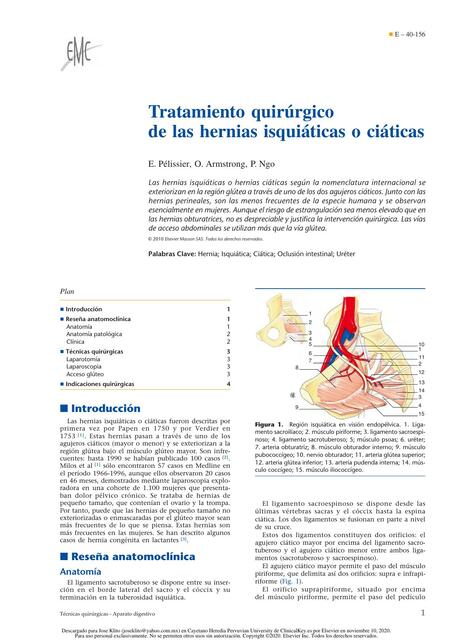 Tratamiento Quirúrgico de las Hernias Isquiáticas o Ciáticas | Mishelle ...
