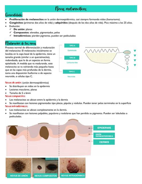 Nevus melanocíticos | Jess | uDocz