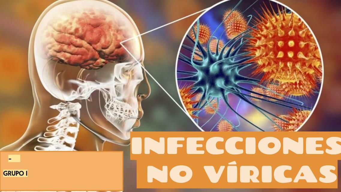 Meningitis aguda | Ariana Ahumada | uDocz