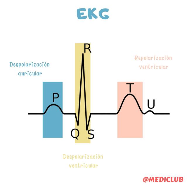 Ekg | MEDICLUB | uDocz