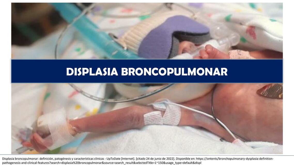 Resúmenes de Displasia broncopulmonar | Descarga apuntes de Displasia ...