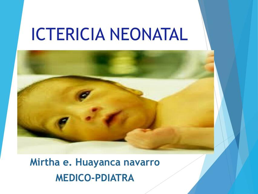 Ictericia Neonatal | yeny gaallrdo | uDocz
