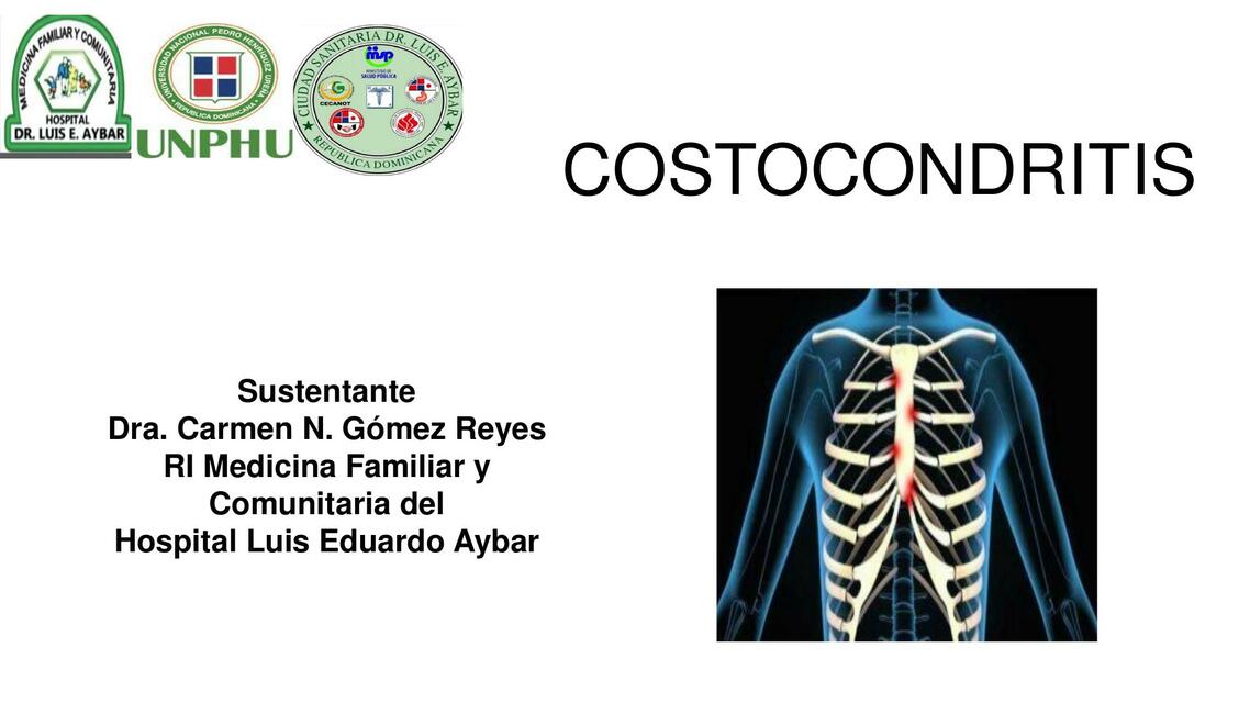Costocondritis | Carmen | uDocz