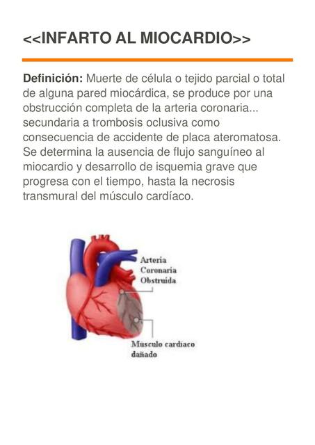 Infarto de miocardio | Clara andrea Cortes vidal | uDocz
