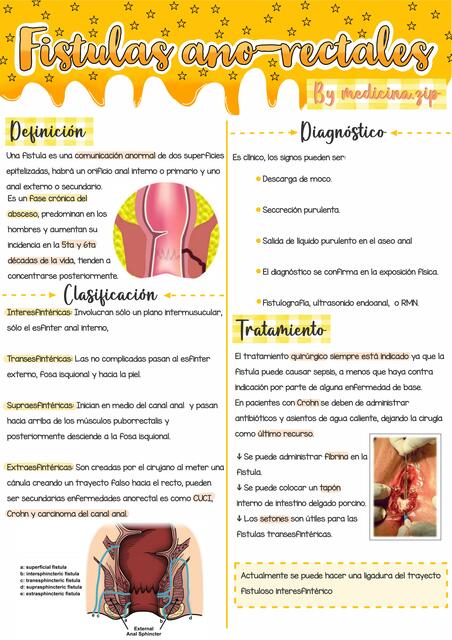 Fístulas anorrectales | Busca y descarga apuntes gratis | uDocz