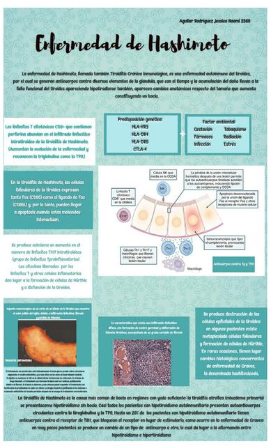 Cuadro Comparativo Causas Enfermedad De Hashimoto Destrucci N De La | My XXX Hot Girl