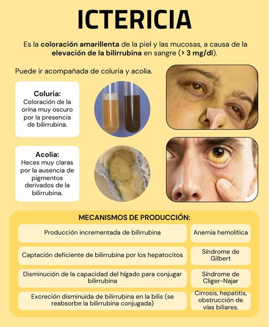 Ictericia | Javier Rios | uDocz