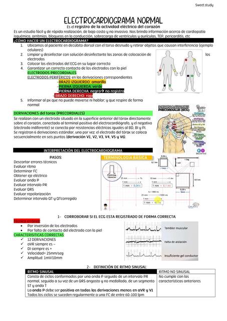 Electrocardiograma Normal | Sweet Study | uDocz