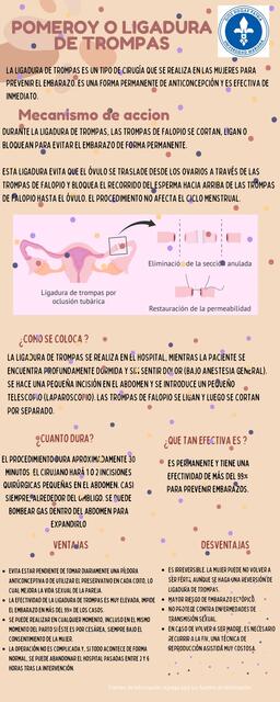 Pomeroy o Ligadura de Trompas | Ema Moran | uDocz