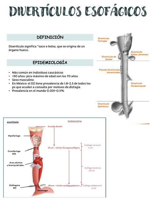 Divertículos esofágicos | Medlink.t | uDocz