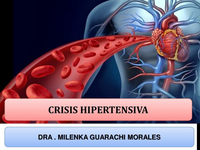 Urgencias Hipertensivas David Lopez Udocz