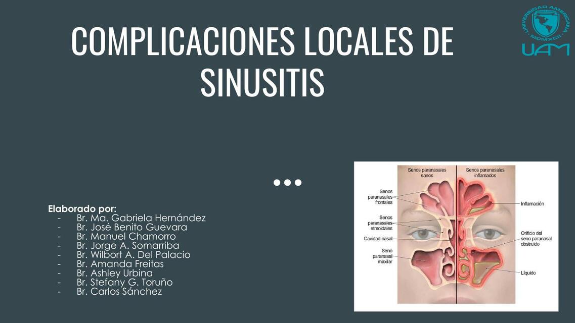 Complicaciones locales de rinosinusitis otorrinolaringología | Amanda ...