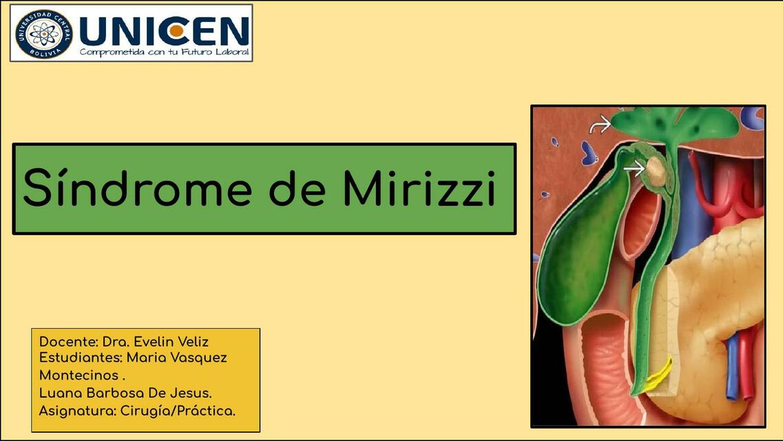Síndrome De Mirizzi hoy | Luana Barbosa | uDocz