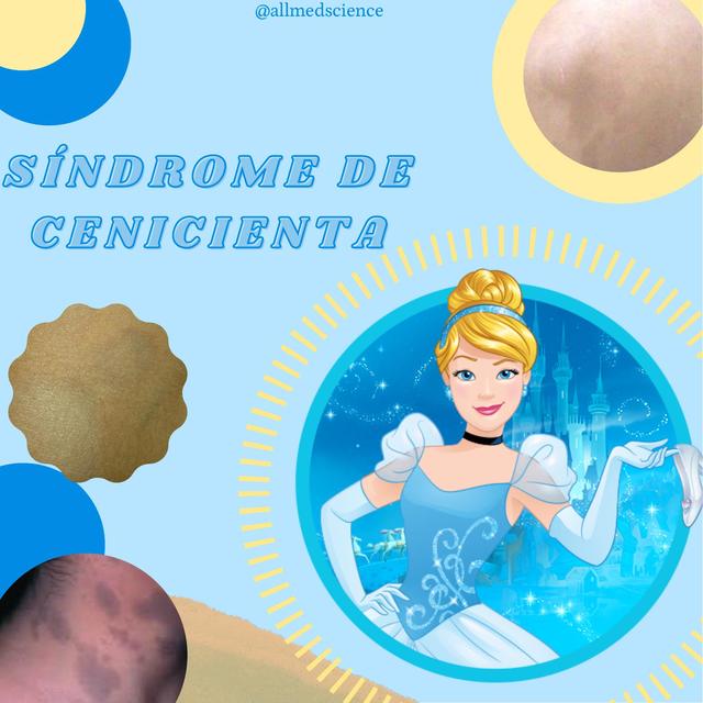 Síndrome de Cenicienta | RoseMedScience ( Rose Mary Favier ) | uDocz
