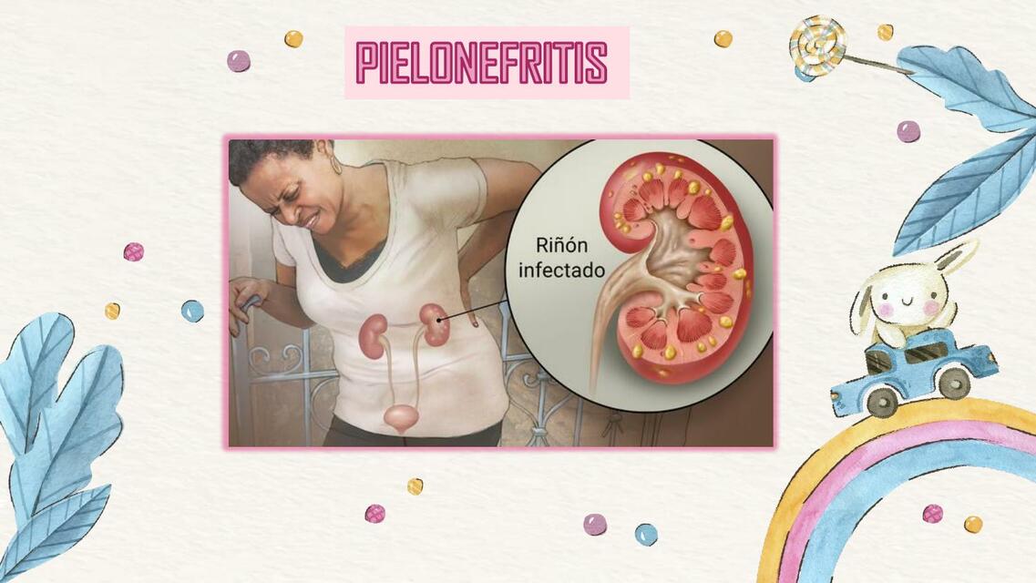 PIELONEFRITIS** | Luzneyra Nicol ROMERO MONTES | uDocz