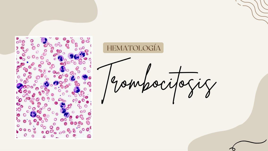 Trombocitosis | Mar.Med | uDocz
