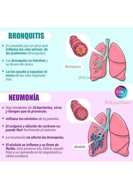Bronquitis y Neumonía | YUDOC.ORG | uDocz